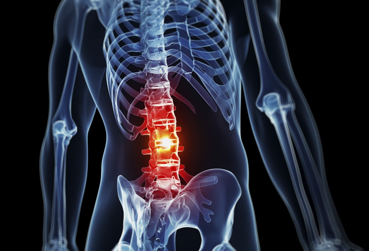 Back Pain Breakthrough Reviews 2025: Honest User Testimonials ...