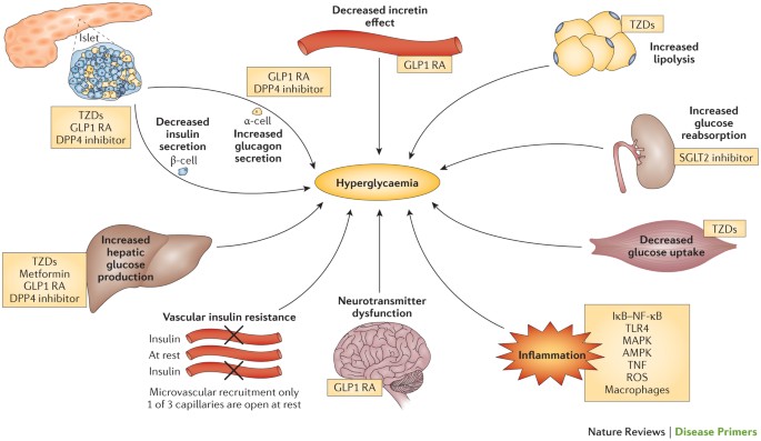 Curing Type 2 Diabetes: Latest Research, Treatments & Lifestyle Changes ...