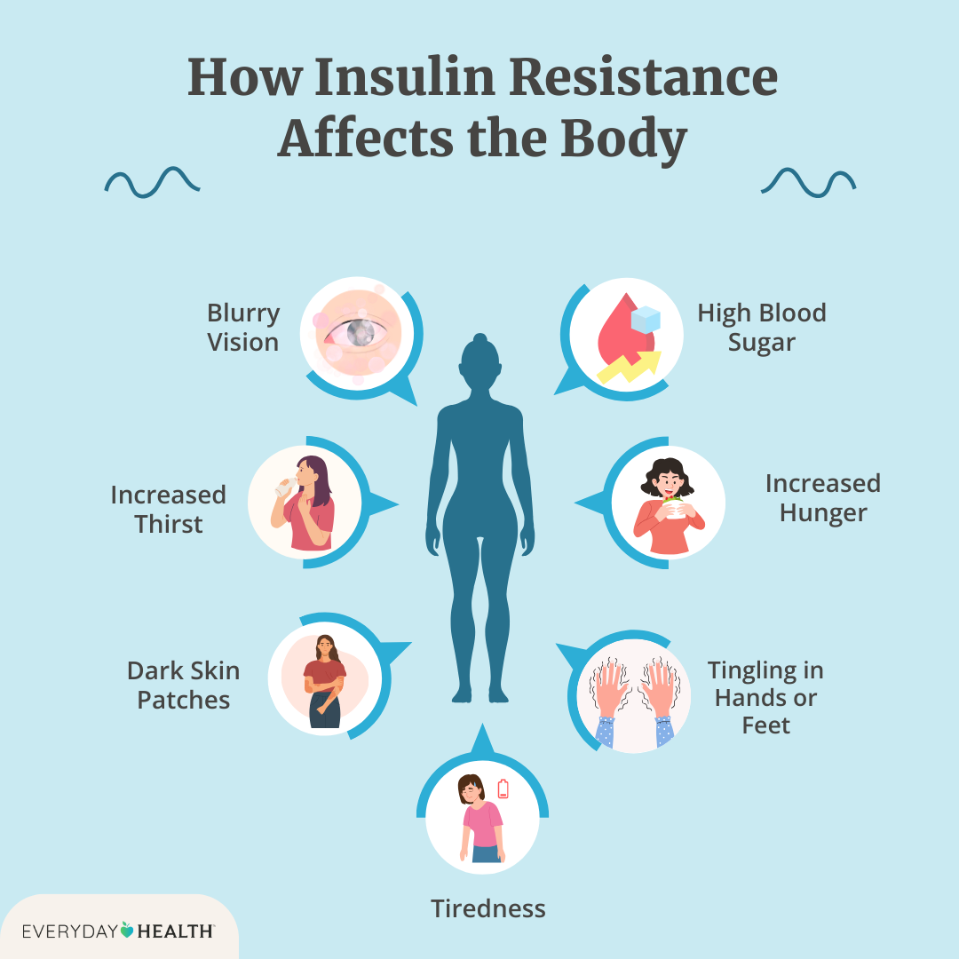 Insulin Resistance And Type 2 Diabetes: Causes, Symptoms, Diagnosis ...