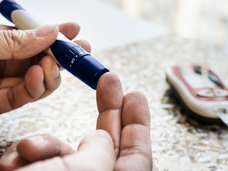 Random Plasma Glucose Test: What It Is, How It Works, & Interpretation ...