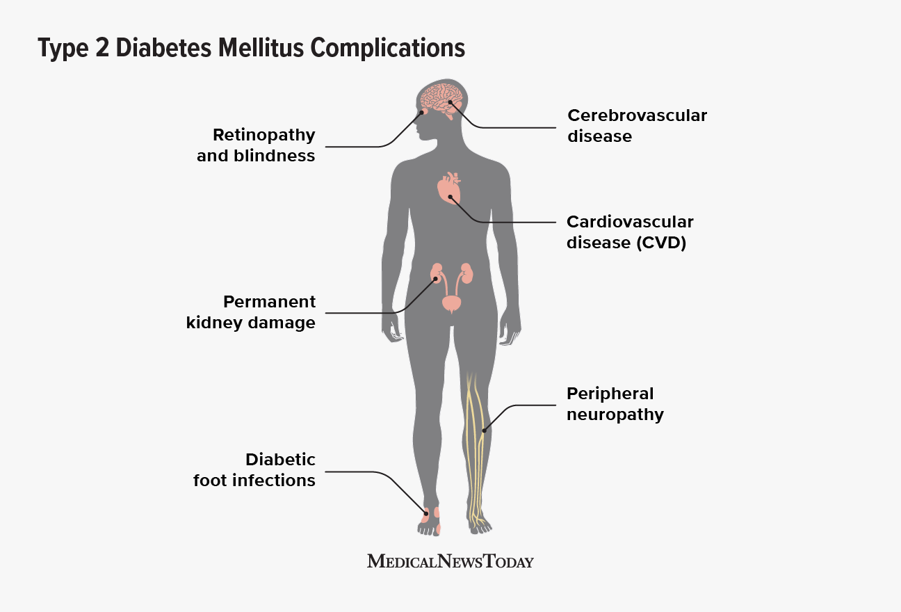 Type 2 Diabetes Complications: Prevention, Management, And Long-Term ...