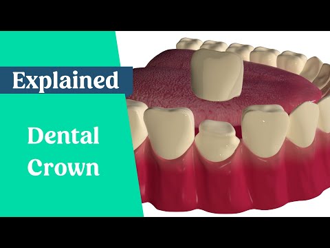 Pain In Tooth With Temporary Crown: Causes, Treatment, And Relief ...
